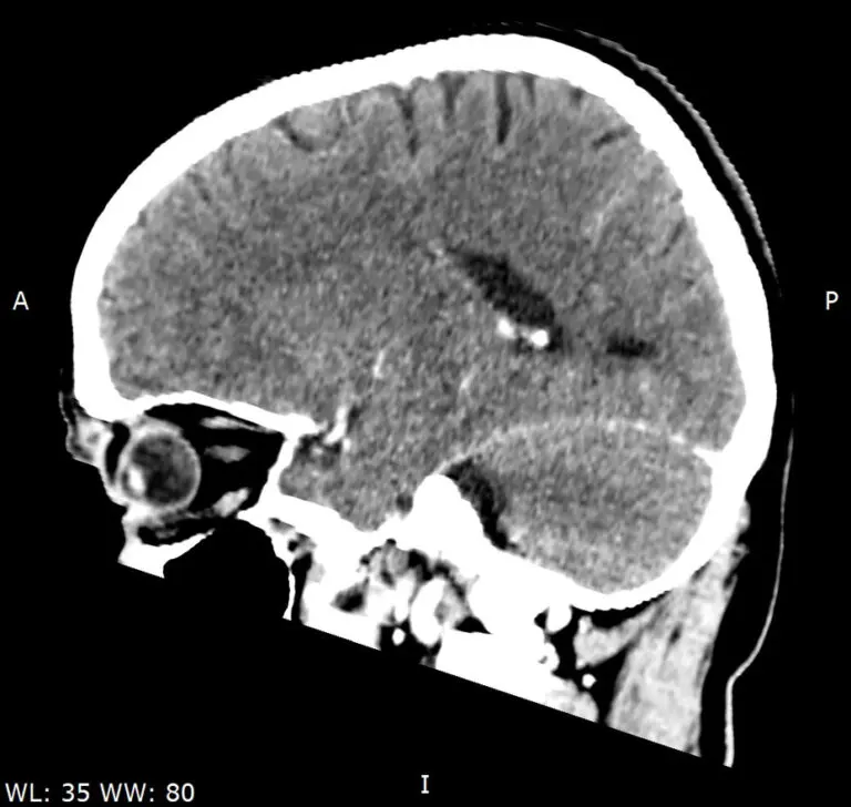 CT glave (mozga) - Delta Dijagnostika Banja Luka